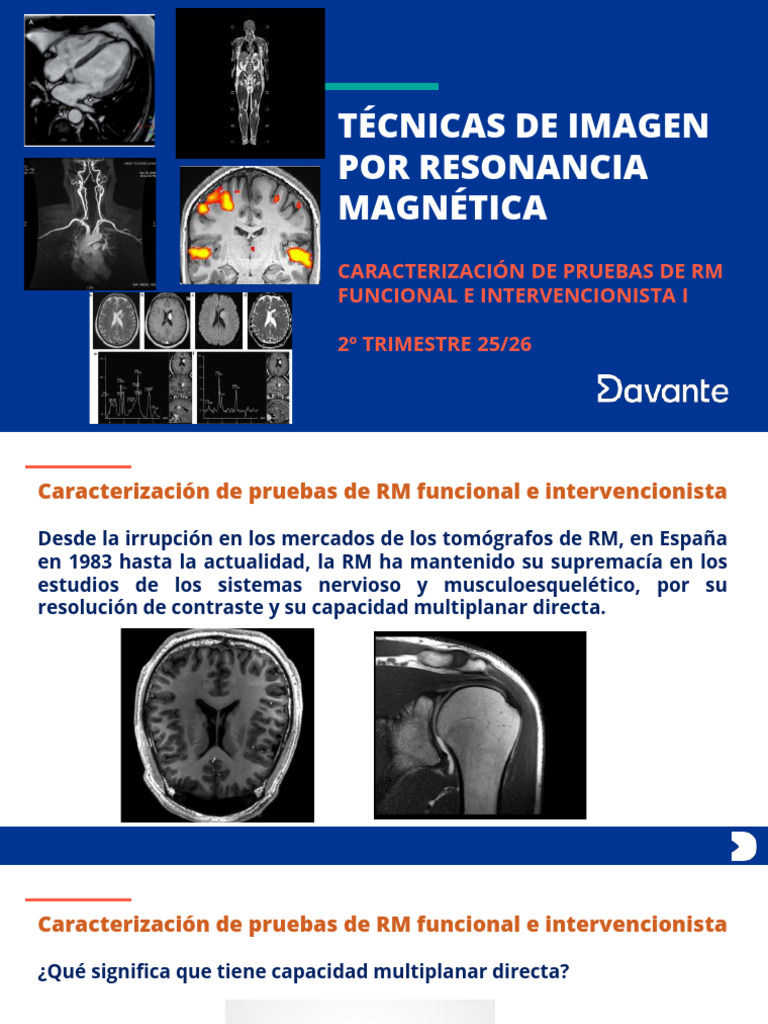 CARACTERIZACIÓN RM FUNCIONAL E INTERVENCIONISTA I | PDF | Imagen de ...