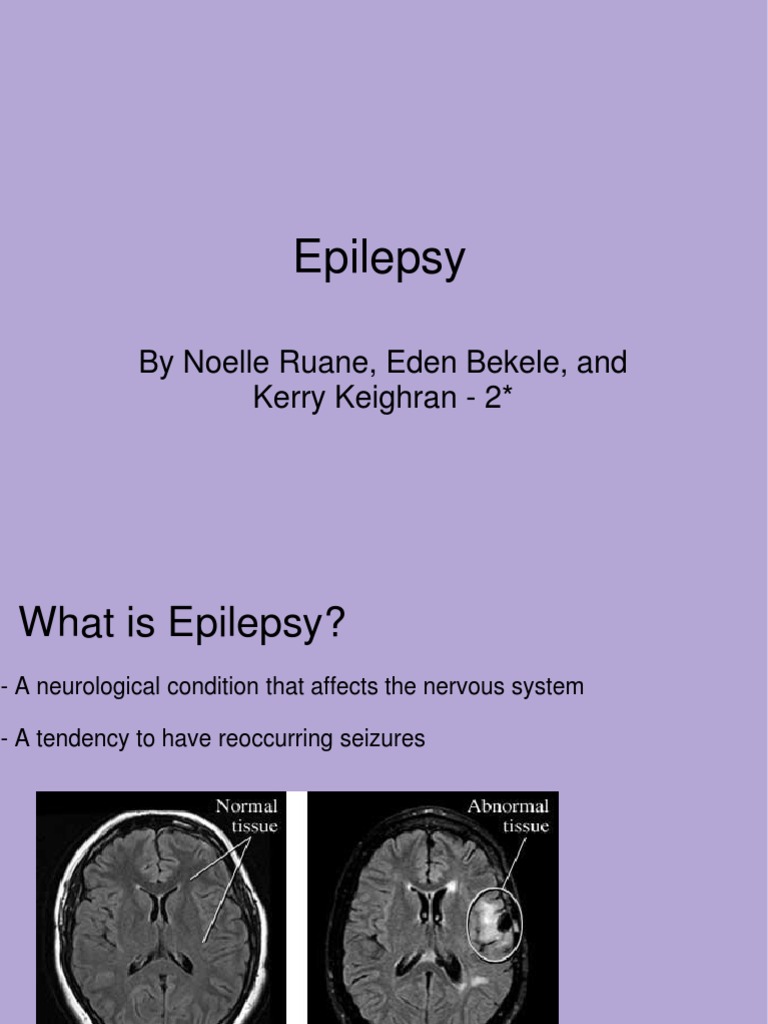 Epilepsy: by Noelle Ruane, Eden Bekele, and Kerry Keighran - 2 | PDF ...