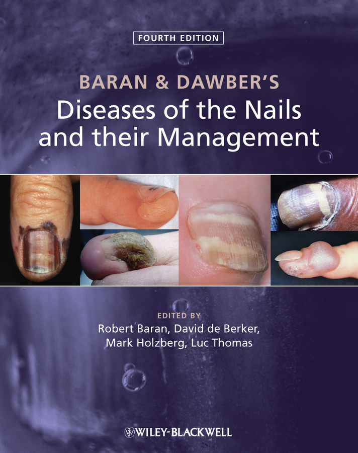 Baran and Dawber's Diseases of the Nails and their Management by Robert ...