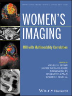 ACR BI-RADS® Atlas Fifth Edition | PDF | Mammography | Clinical Medicine