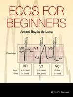 Delta Wave - LITFL Medical Blog - ECG Library Basics | PDF | Cardiac ...