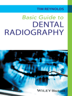Exposure Chart | PDF | X Ray | Radiography