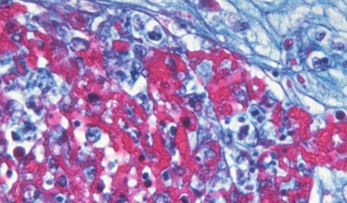 Scientists Recreate an Extinct Virus, Triggering New Warnings About ...