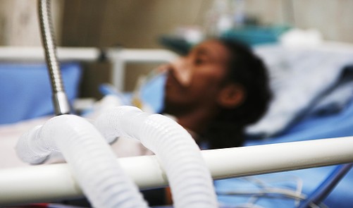 Sepsis Kills Millions More Worldwide Than Previously Estimated - NPR ...