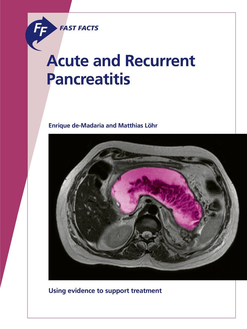 Fast Facts: Acute and Recurrent Pancreatitis by E. de-Madaria, M. Löhr ...