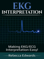 ECG Interpretation | PDF | Electrocardiography | Heart