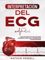 Tabla_ Valores normales de ondas e intervalos del ECG | PDF | Corazón ...
