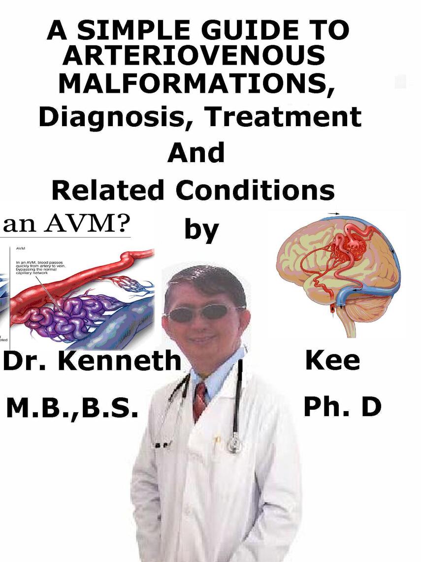 A Simple Guide to Arteriovenous Malformations, Diagnosis, Treatment and ...