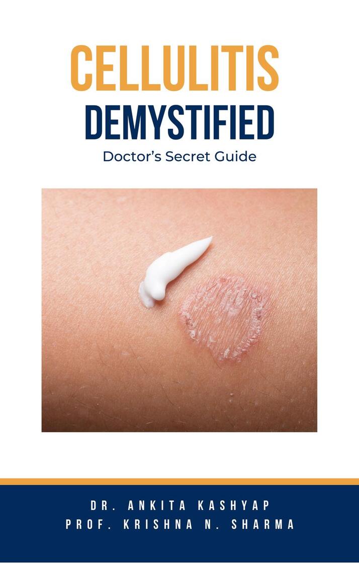 Cellulitis Demystified: Doctor's Secret Guide by Dr. Ankita Kashyap, Prof. Krishna N. Sharma ...