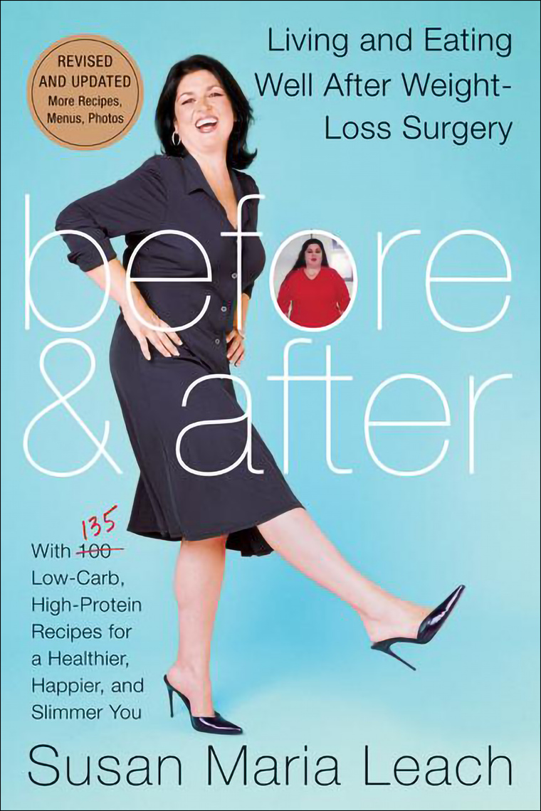 Before & After by Susan Maria Leach (Ebook) - Read free for 30 days