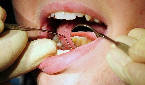 Labour Vows To ‘Put A Smile Back On Kids’ Faces’ With Child Dentistry ...