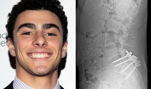 Luigi Mangione ‘Went Missing’ After Back Surgery And Struggled With ... Luigi Mangione ‘Went Missing’ After Back Surgery And Struggled With ...