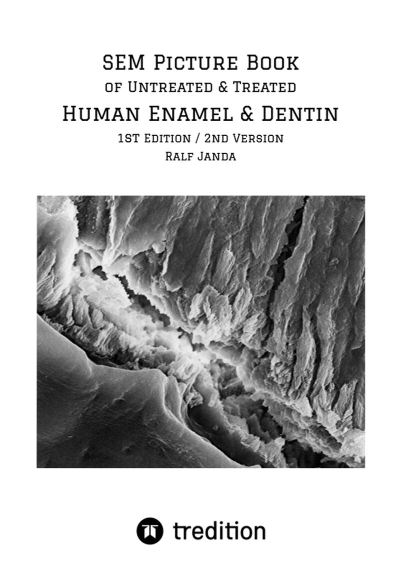 SEM Picture Book of Untreated & Treated Human Enamel & Dentin by Ralf ...